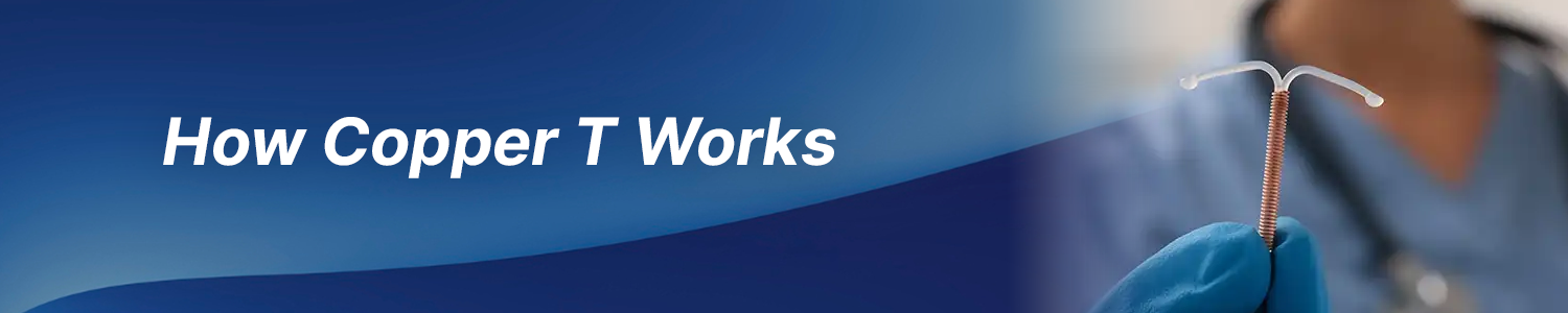 Copper T IUD: Function, Insertion, and Removal Explained | Medikabazaar