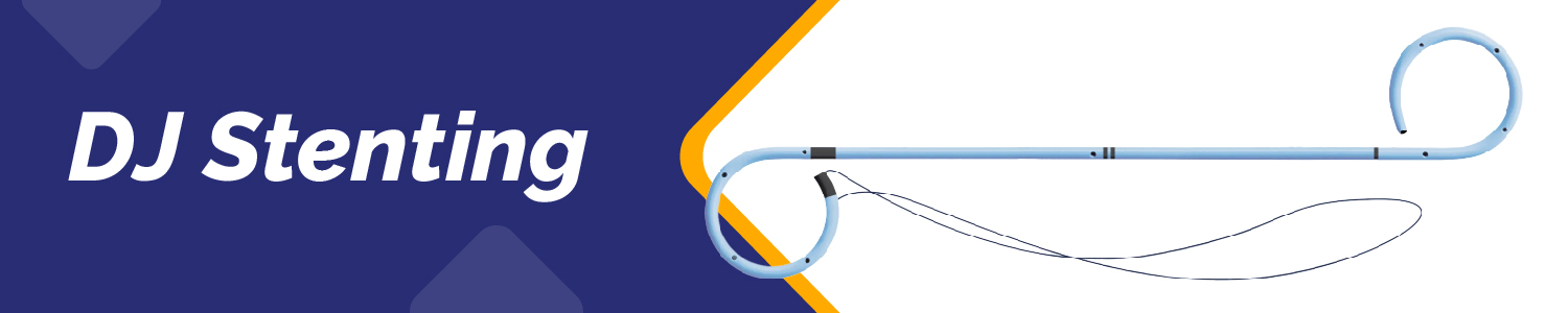 DJ Stenting: Benefits, Placement & Recovery | Medikabazaar | Medikabazaar